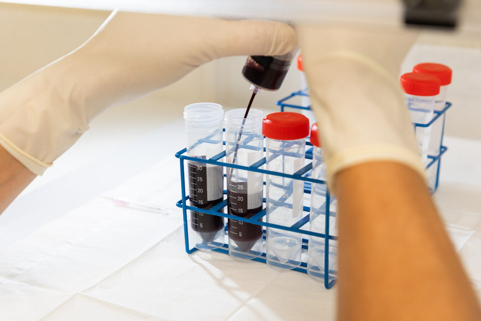 Ozone therapy in Charleston | InterveneMD